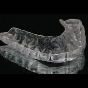 Grinding and Occlusal Splints